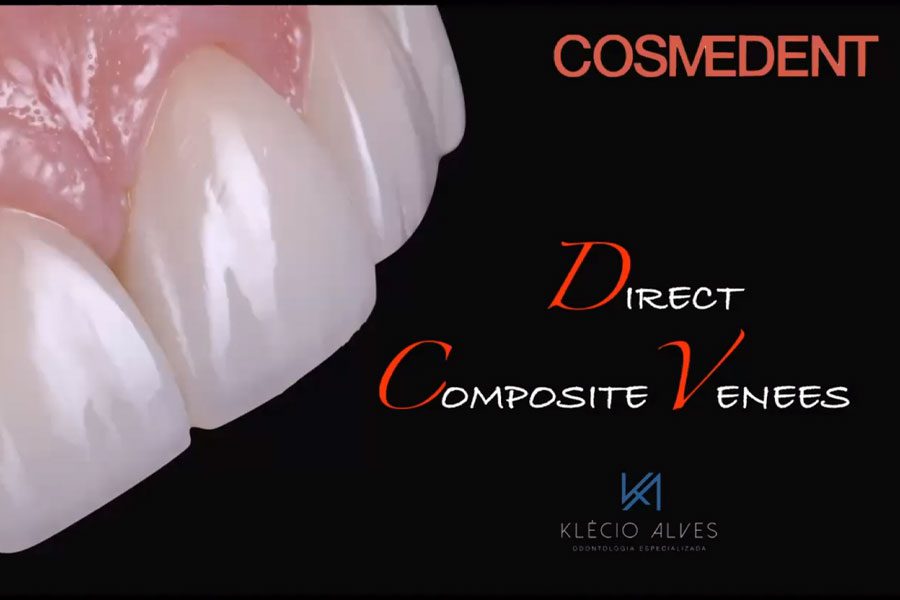 Webinar Direct Composite Veneers | Dr. Rhodri Thomas